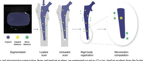 Figure 2 From Full Field Measurement Of Micromotion Around A Cementless Femoral Stem Using Micro