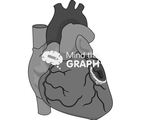 Free Anterobasal Infarct Icons Symbols Pictures And Images Mind The Graph