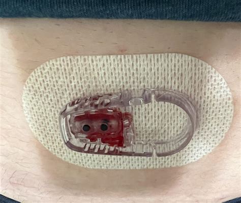 The Next Generation Of Continuous Glucose Monitors Freestyle Libre 3 Vs Dexcom G7 R Dexcom