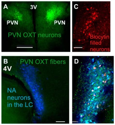 Sex Differences In The Hypothalamic Oxytocin Pathway To Locus Coeruleus
