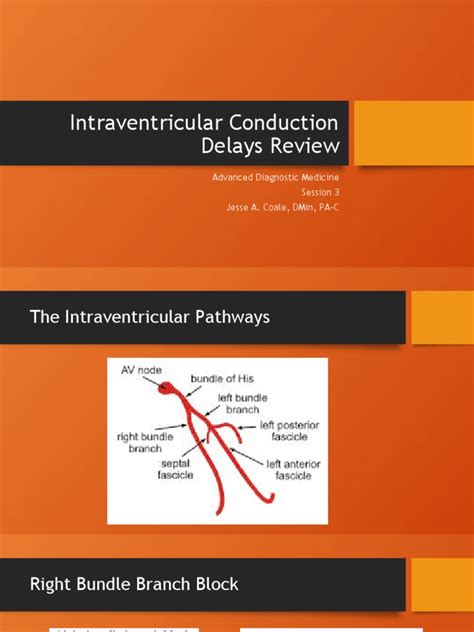 Intraventricular Conduction Delays Review Pdf Electrocardiography Cardiovascular System