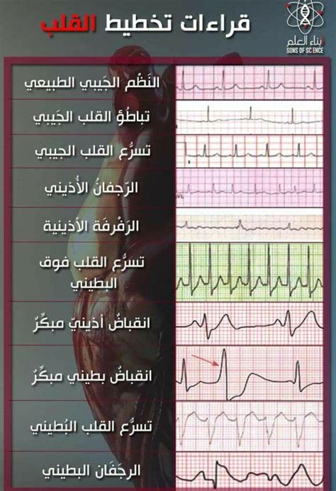 ماذا تعنيه الاشكال المختلفة الذي تشاهدها على جهاز تخطيط القلب Ali