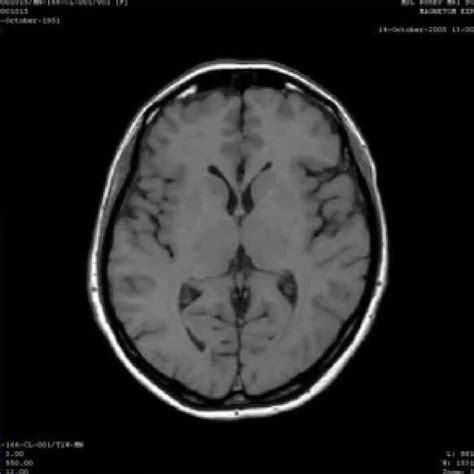 Microdicom Dicom Viewer Download Free 2022 1 Techspot