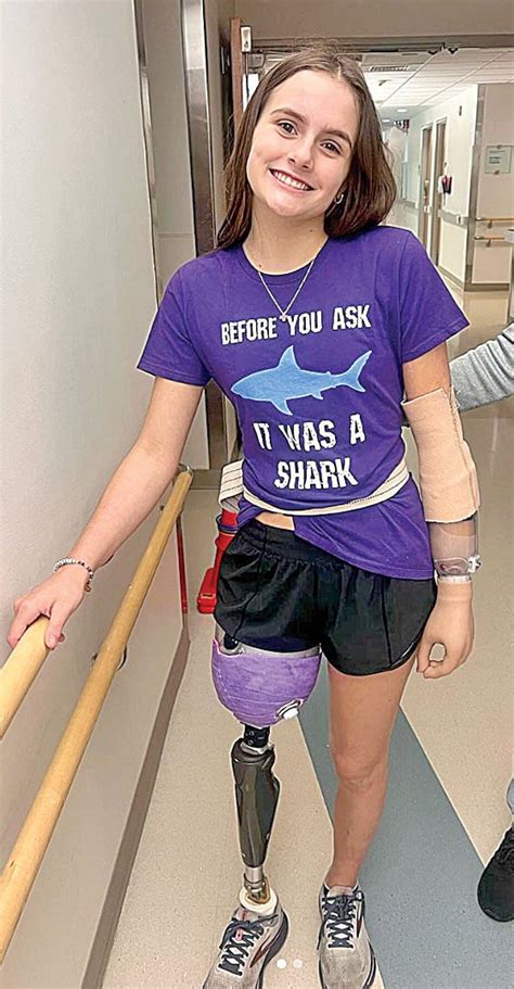 Lulu Strong Mountain Brook Teen Lulu Gribbin Defying The Odds After