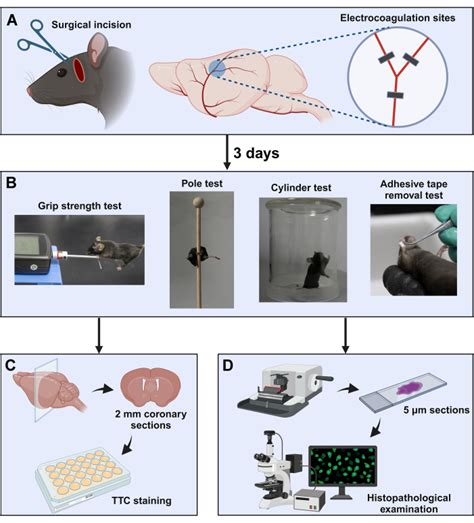 Induction Of Acute Ischemic Stroke In Mice Using The Distal Middle