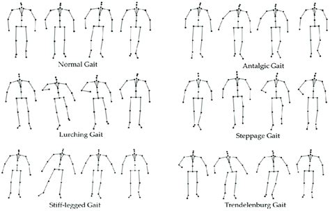 Normal And Pathological Gaits Download Scientific Diagram