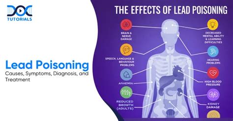 Lead Poisoning Neet Pg Causes Symptoms Diagnosis And Treatment