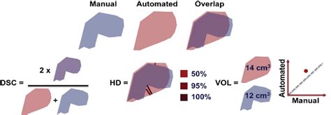 Automated Segmentation Of Epilepsy Surgical Resections Three Metrics Download Scientific