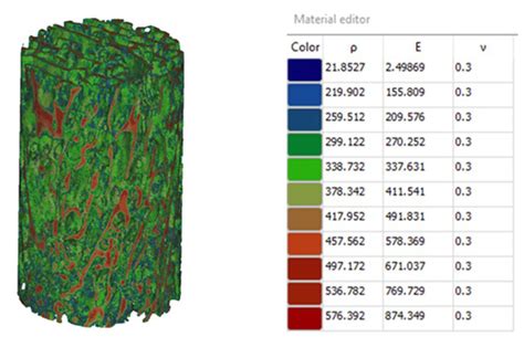 Customized Lattice Structures Tailored To Mimic Patients Bone Anisotropic Properties And
