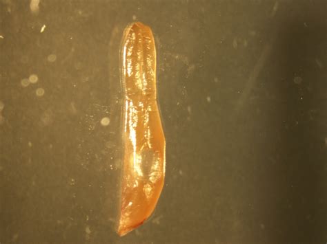What Do Tapeworms In Human Stool Look Like