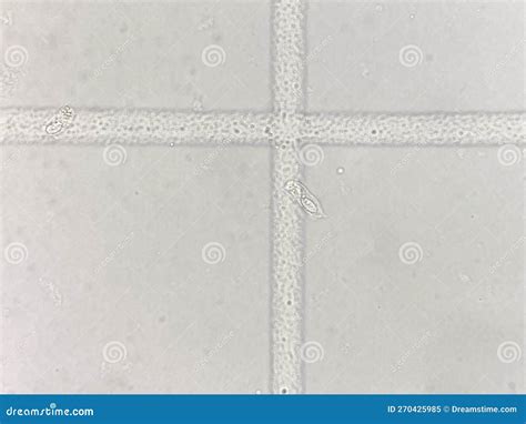 Renal Tubular Epithelial Cell In Urine Stock Image Image Of Health