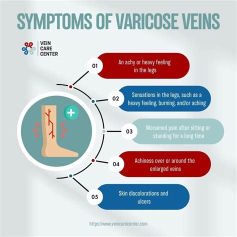 How To Deal With Varicose Veins Vein Care Center