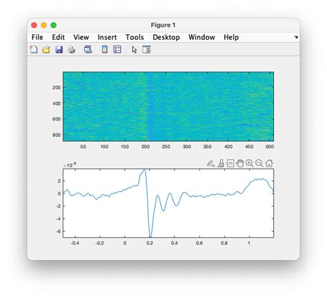 Preprocessing Raw Data And Computing ERPs ERFs FieldTrip Toolbox