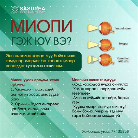 МИОПИ ГЭЖ Сасуриа нүдний эмнэлэг Sasurea Eye Clinic Facebook