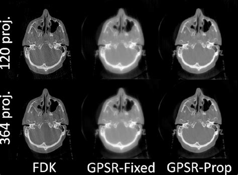 Figure 1 From An Efficient Iterative Cbct Reconstruction Approach Using Gradient Projection