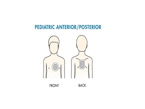 Cardioversion And Defibrillation نذيرpptx