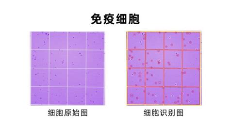 金标准细胞计数方法使用血细胞计数板人工计数的详细步骤与注意事项 生物器材网