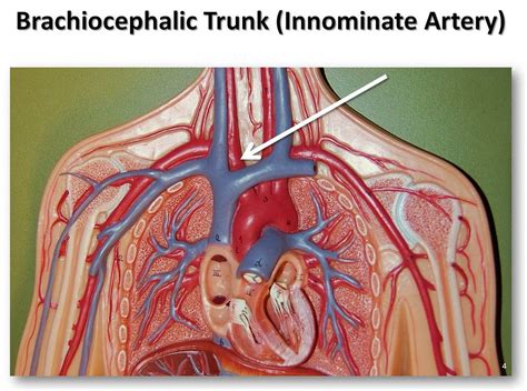 Brachiocephalic Trunk The Anatomy Of The Arteries Visual Guide Page