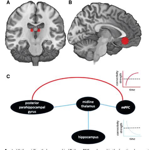 Figure 2 From Transient Relay Function Of Midline Thalamic Nuclei During Long Term Memory