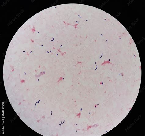 Smear Of Gram Positive Bacilli With Chinese Letters Shape Bacteria