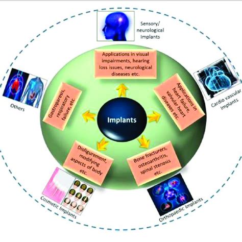 Application Oriented Categorization Of Bioimplants Into Categories Download Scientific