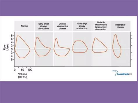 Pulmonary Flow Volume Loops Dr Padmesh Pptx Lung And Respiratory