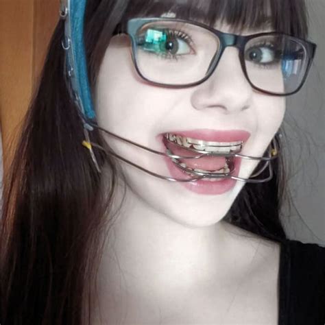 Headgear Braces Explore Tumblr Posts And Blogs Tumgik