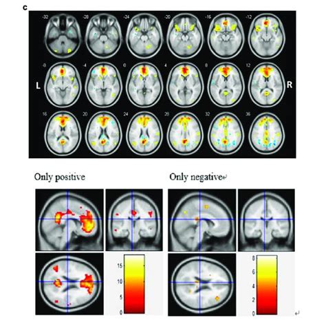 A Regions Showing Significant Differences In Default Mode Network Download Scientific
