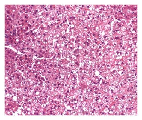 Hande Staining For Histological Evaluation Typical Photographs Of Liver