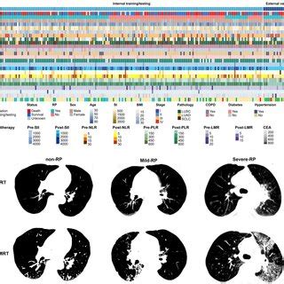 Clinical Characteristics And Classification Of The Lung Cancer Download Scientific Diagram
