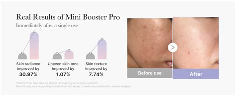 Medicube Age R Booster Pro Mini Mykoco