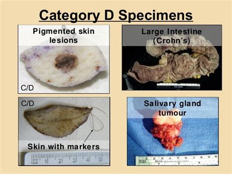 Histopathology In Practice Sample Reception Dissection Processing…
