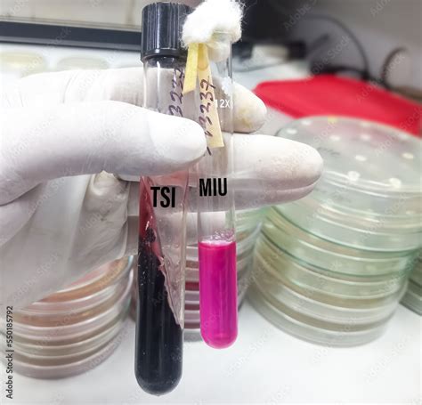 Biochemical Test For Gram Negative Bacteria Tsi Motility And Indole