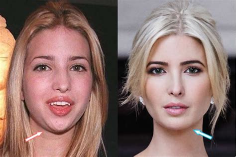 10 Maga Women Who Look Unrecognisable After Transformation In Before