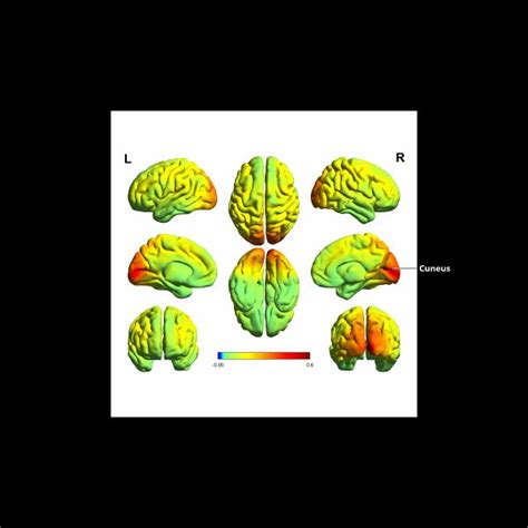 Primary Visual And Visual Association Cortex Areas 17 18 19