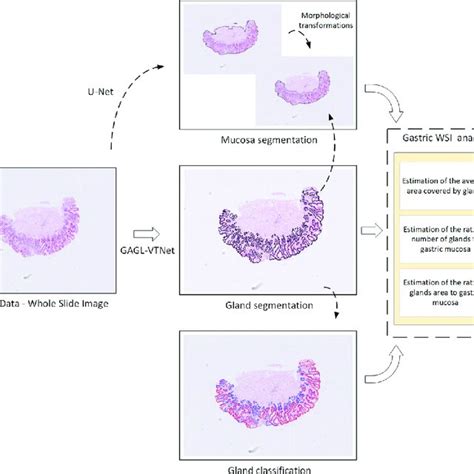 The Proposed Framework For Gastric Gland Segmentation Classification Download Scientific