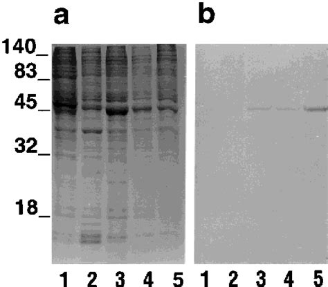 Immunoblot Analysis With The Monoclonal Antibody Against Sma Of Download Scientific Diagram