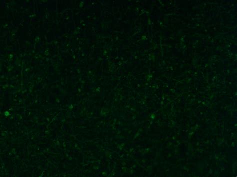 Vitroview™ Thioflavin S Stain Kit