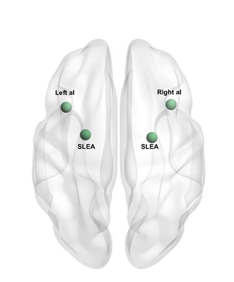 Intrinsic Functional Connectivity Map For The Salience Network P