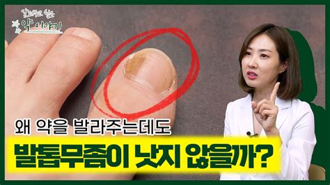 발톱무좀약 이렇게 발라야 효과를 볼 수 있습니다 Youtube