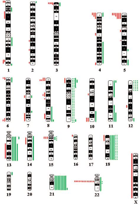 Ideogram Summarizing The Clinically Significant Cnvs In 109 Neonates Download Scientific