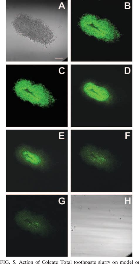 figure 5 from direct visualization of spatial and temporal patterns of antimicrobial action