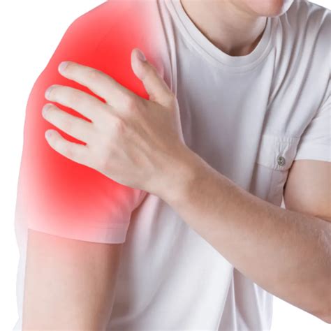 Calcific Tendonitis Causes Symptoms And Treatment