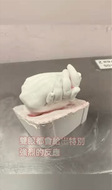 天瑜醫療事故｜天瑜情況較上周穩定 仍需使用強心藥 花3小時製作手模留念 星島日報