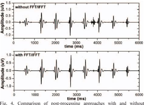 Figure 4 From Fetal Heart Rate Detection And Monitoring From Noninvasive Abdominal Ecg
