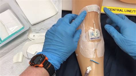How To Dress A Picc Line At Holly Mellott Blog