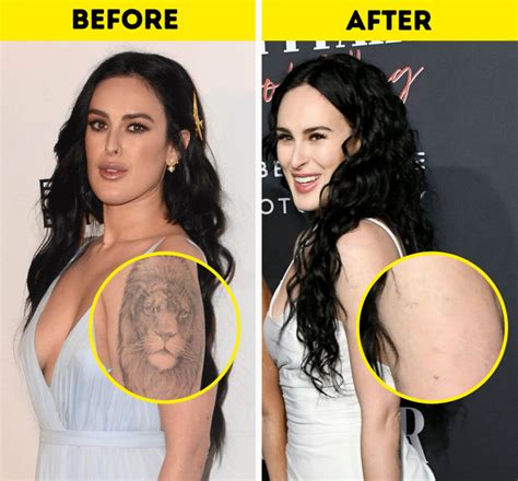 Tattoo Regrets 15 Celebrities Who Decided To Erase Their Ink