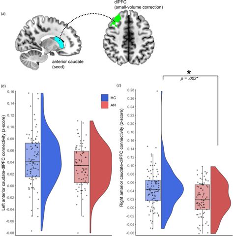 Reduced Dorsal Fronto Striatal Connectivity At Rest In Anorexia Nervosa Pmc