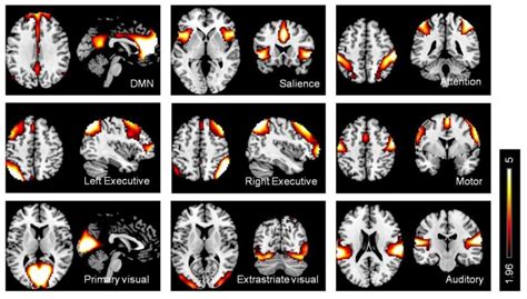 Dynamic Brain Functional Connectivity Modulated By Resting State Networks Pmc