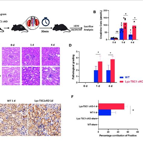 Decreased Renal Fibrosis After Iri In Lyz Tsc1 Cko Mice A